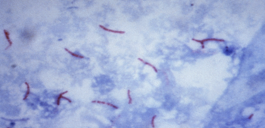 Solved The next image is _________________staining. What | Chegg.com