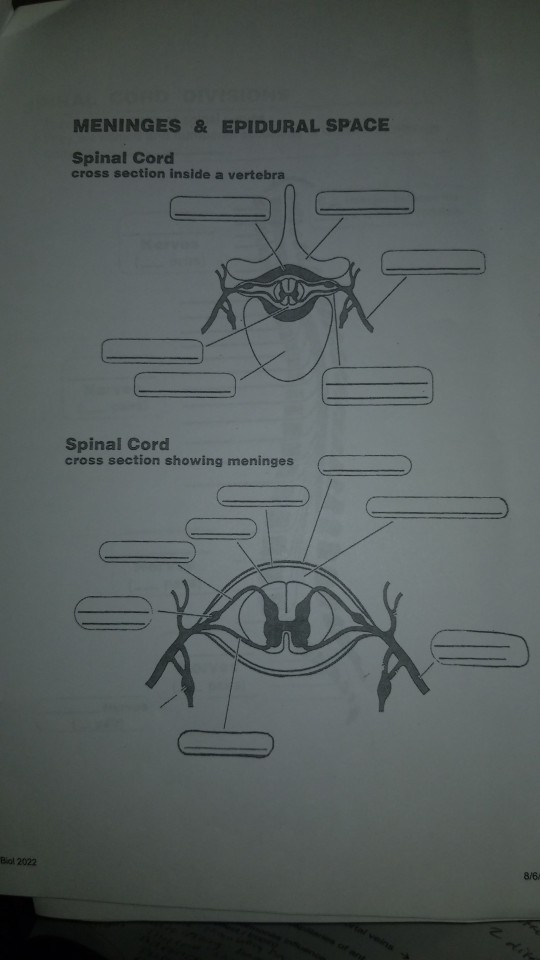 Solved MENINGES & EPIDURAL SPACE Spinal Cord cross section | Chegg.com