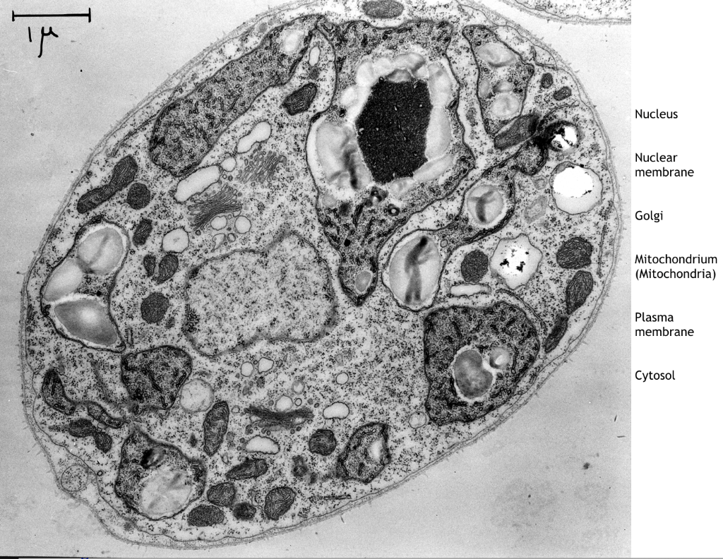 Solved Identify structures in the EM micrographs Match the | Chegg.com