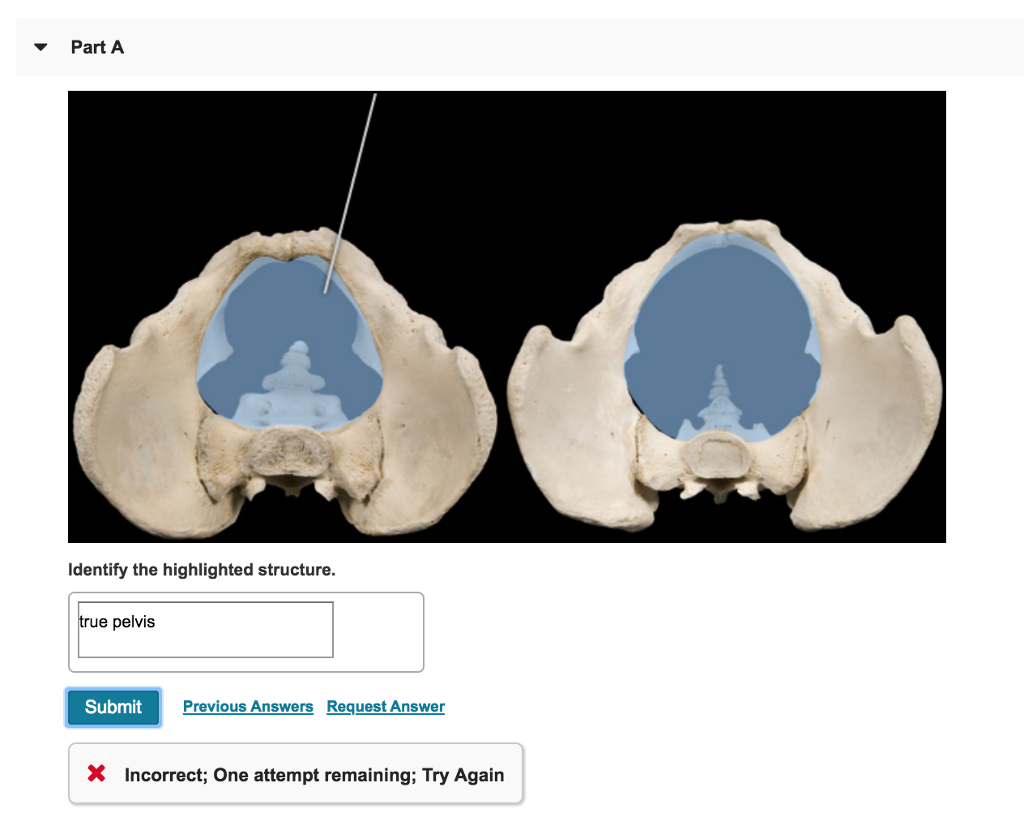 Solved PartA Identify the highlighted structure rue pelvis | Chegg.com