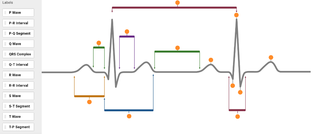 Solved Labels P Wave P-R Interval P-Q Segment Q Wave QRS | Chegg.com