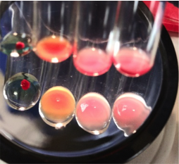 The following photos are ABORh Forward Typing Tube | Chegg.com