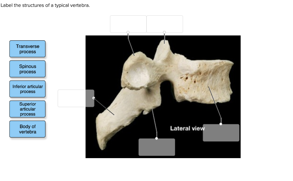 Solved Label the structures of a typical vertebra. | Chegg.com