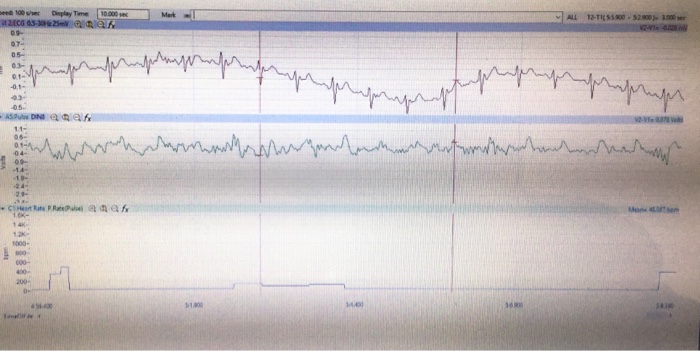 Solved How does the average R-Pulse interval from rest and | Chegg.com