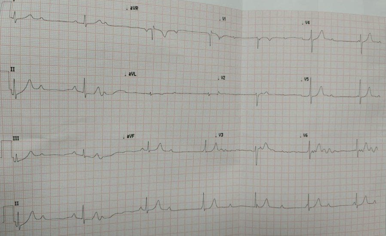 Solved Clinical case 3: the teenage emergency. Analyze the | Chegg.com