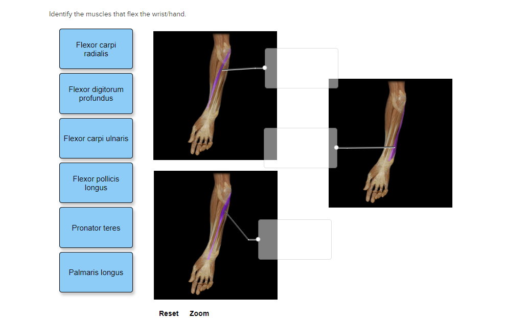 Solved dentify the muscles that flex the wrist/hand. Flexor | Chegg.com