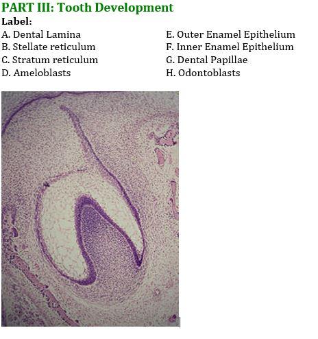 Solved PART III: Tooth Development Label: A. Dental Lamina | Chegg.com