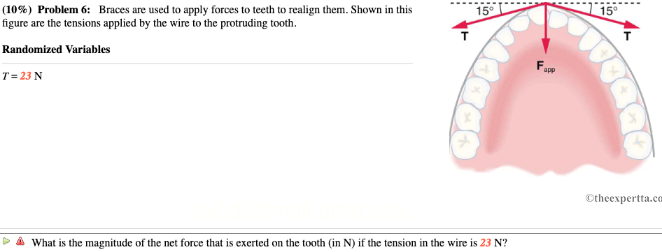 Solved: (10%) Problem 6: Braces Are Used To Apply Forces T... | Chegg.com