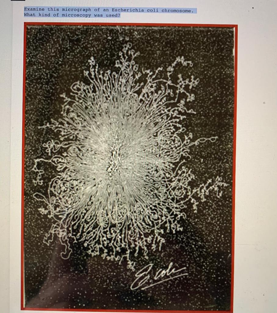 Solved Examine this micrograph of an Escherichia coli | Chegg.com