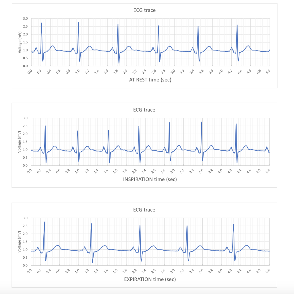 Solved DATA1. ECG. Table 1. Copy in the properly formatted | Chegg.com