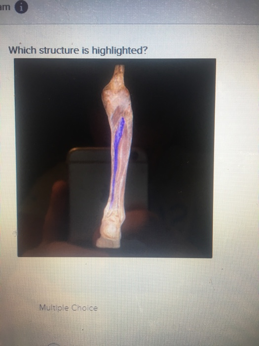 Solved Which structure is highlighted? Multiple Choice | Chegg.com