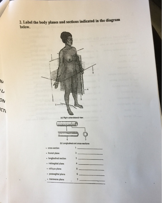 2. Label the body planes and sections indicated in | Chegg.com