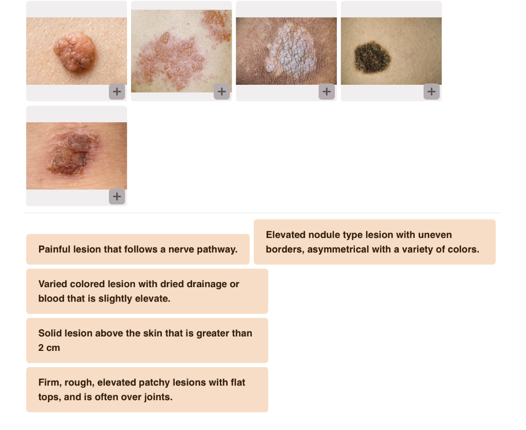 Solved + Elevated nodule type lesion with uneven borders, | Chegg.com