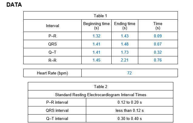 Solved Analyzing the Heart with EKG Data analysis 1. | Chegg.com