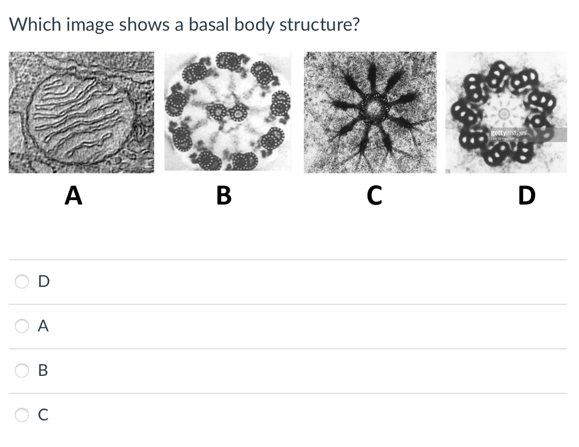 Solved Which image shows a basal body structure? B D A B C | Chegg.com