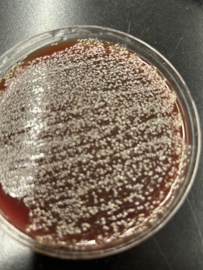 Solved what type of hemolysis is on blood agar choose two | Chegg.com