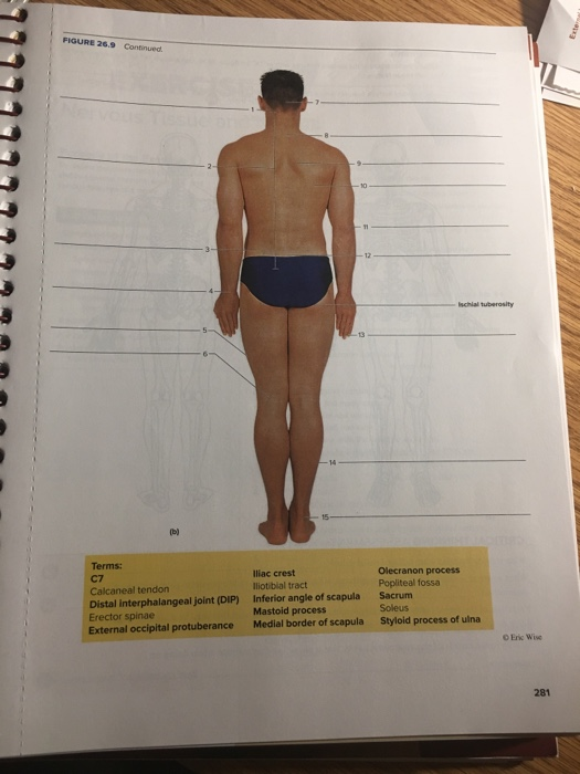 Solved PART B: Assessments Label figure 26.9 with the | Chegg.com
