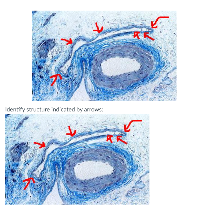 Solved Identify structure indicated by arrows: | Chegg.com