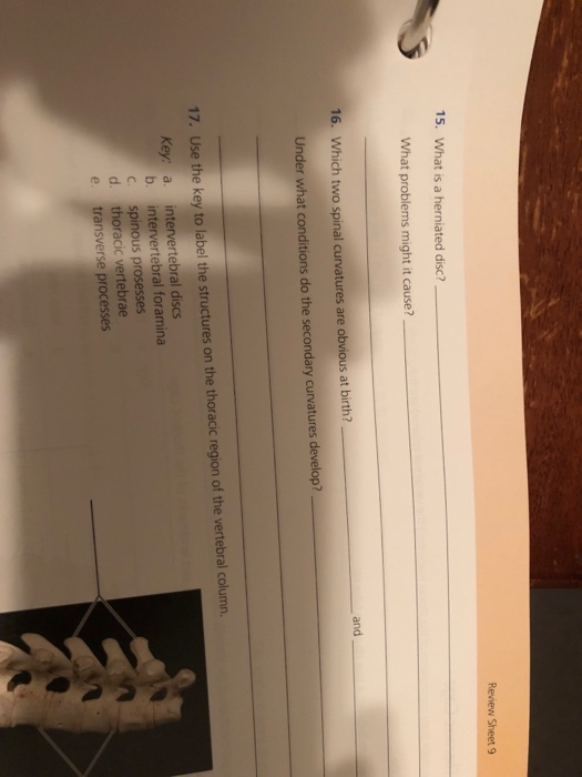 Solved 3. Define suture 4. With one exception, the skull | Chegg.com