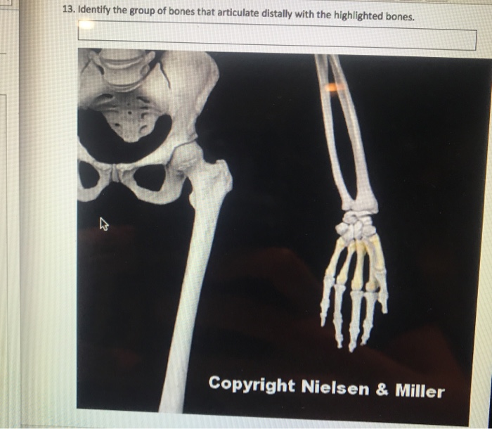 Solved entify the group of bones that articulate distally | Chegg.com