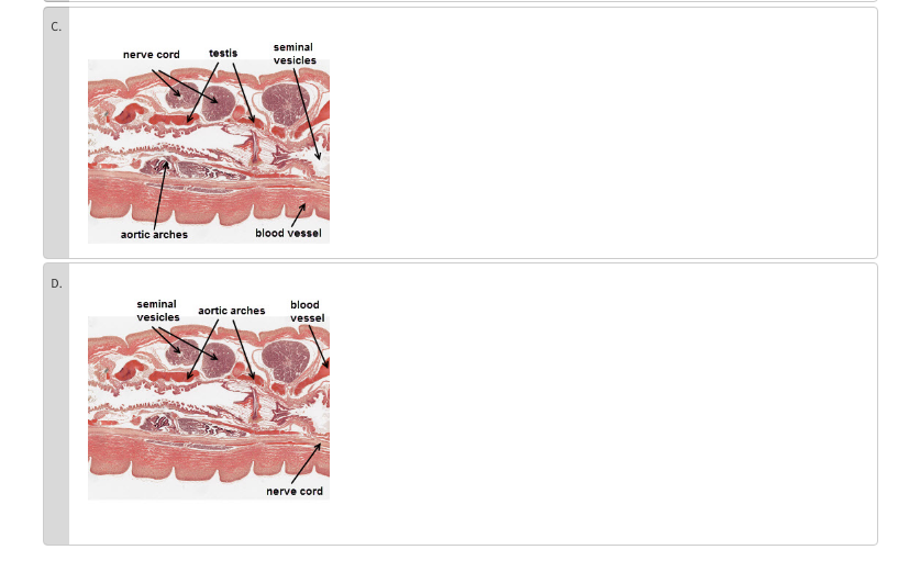Lumbricus Longitudinal Section
