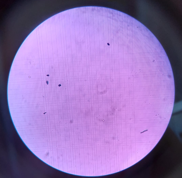 Solved Experiment : CELL COUNTING AND VIABILITYplease count | Chegg.com