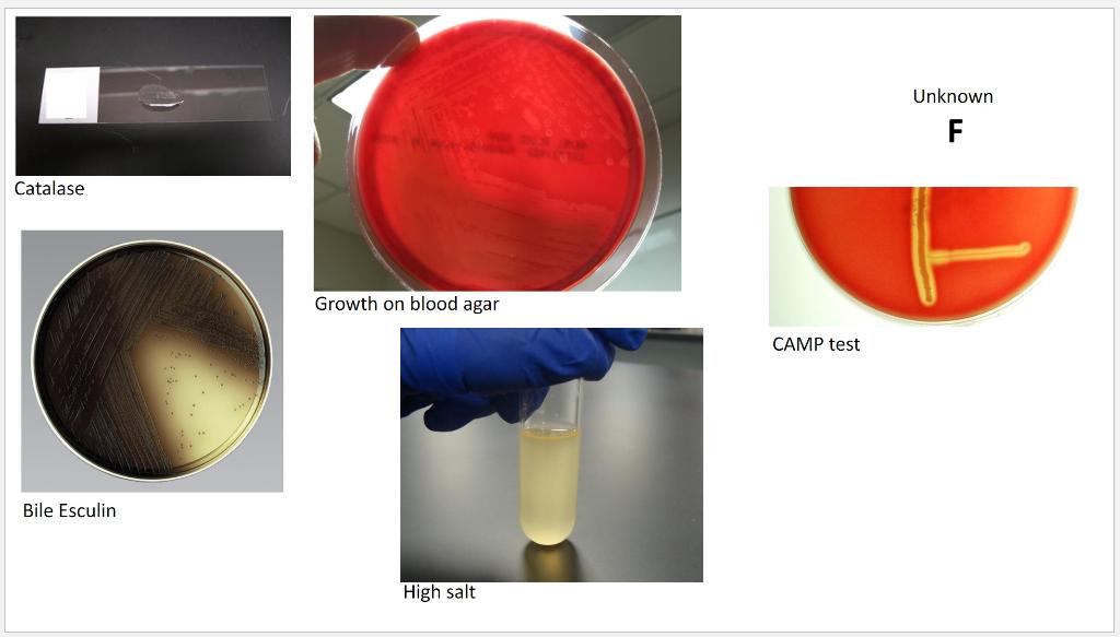 Solved Unknown F Catalase Growth on blood agar CAMP test | Chegg.com