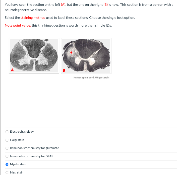Solved You have seen the section on the left (A), but the | Chegg.com