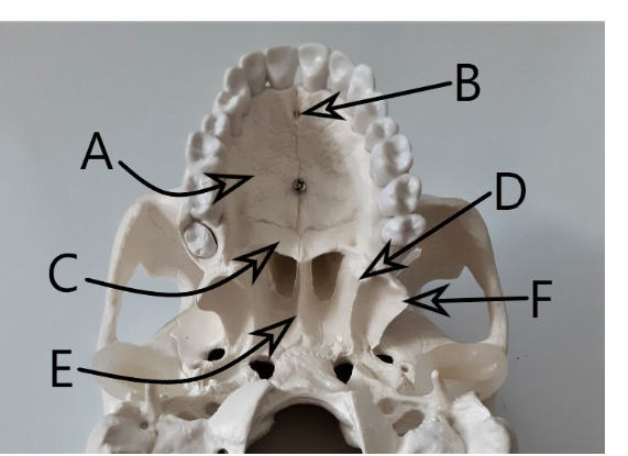 Solved 1.The projection "A" is [ Select ] ["zygomatic | Chegg.com