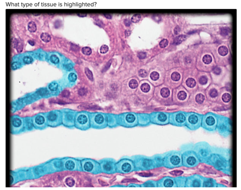 Solved What type of cell is highlighted in this image? | Chegg.com
