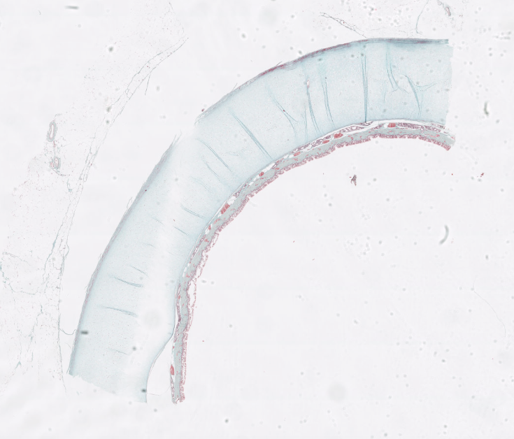 Solved The following pictures show a trachea on a microscope | Chegg.com