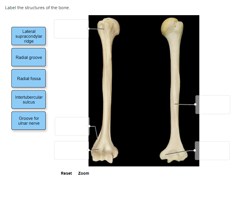 Solved Label the structures of the bone. | Chegg.com