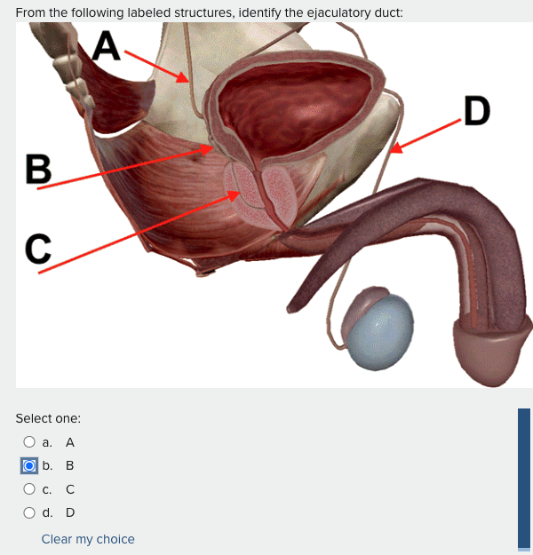Solved What male reproductive system is colored in blue and | Chegg.com