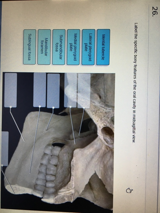 Solved 26 Label the specific bony features of the oral | Chegg.com Solved 26 Label the specific bony features of the oral | Chegg.com