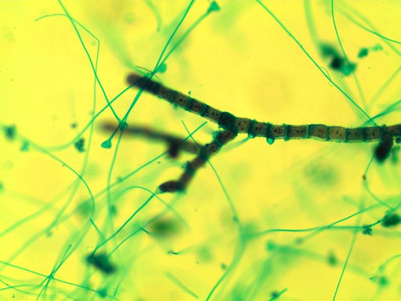 Use dichotomous key to identify the genus of the | Chegg.com