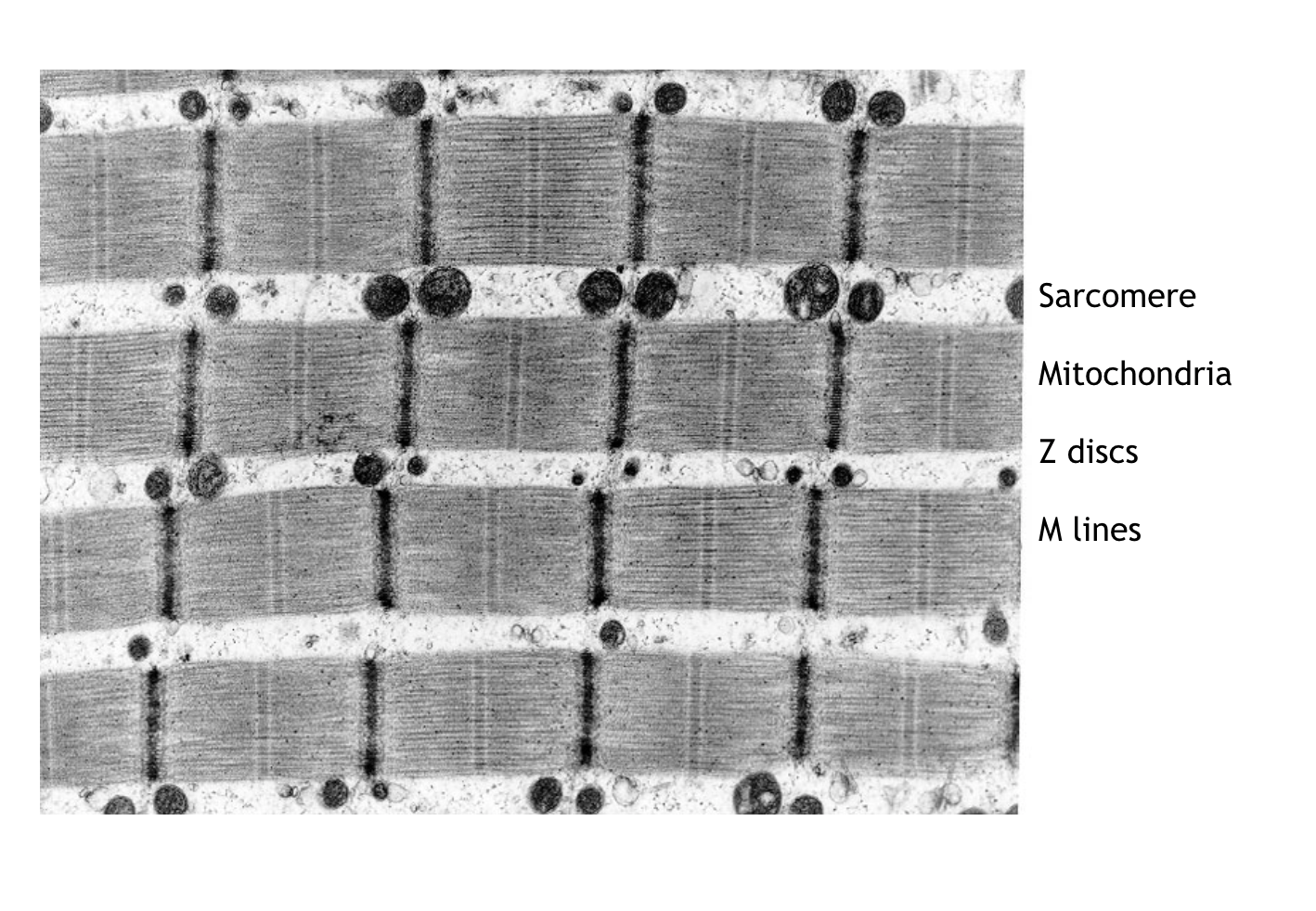 Solved Identify structures in the EM micrographs Match the | Chegg.com