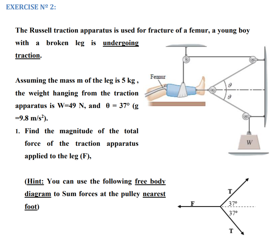 Solved EXERCISE N° 2: The Russell traction apparatus is used | Chegg.com
