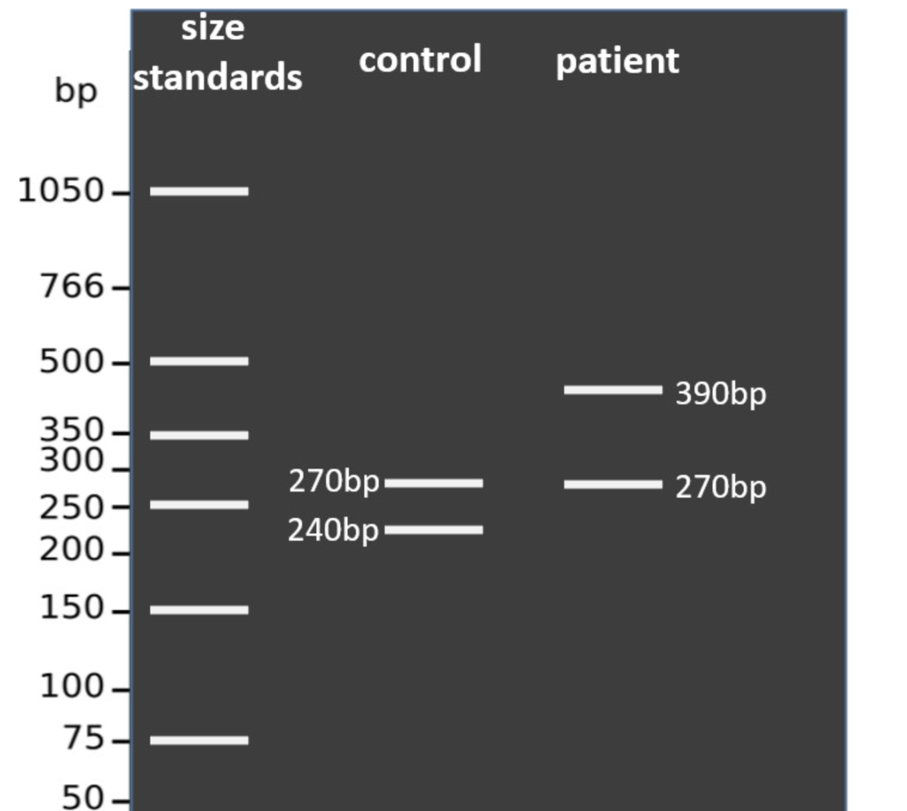 Solved Having identified the repeating unit of the STR in | Chegg.com