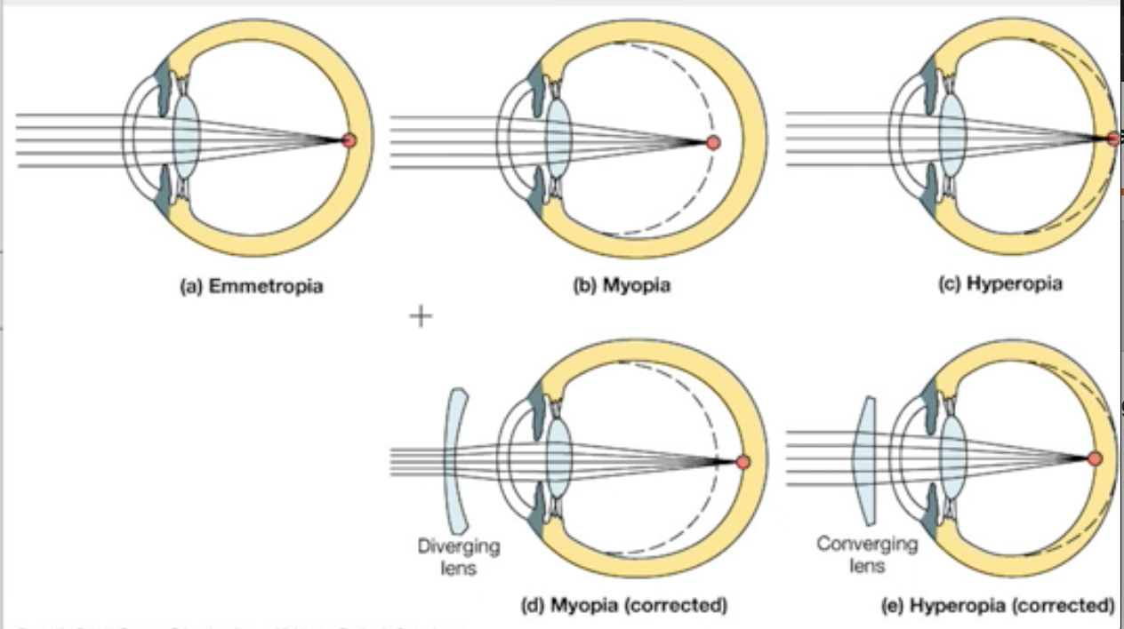 Solved For d and e, draw the appropriate type of corrective | Chegg.com