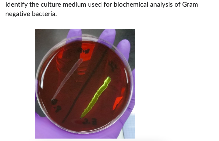 Solved Identify the biochemical test to differentiate Gram's | Chegg.com
