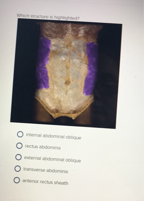 Solved Which structure is highlighted? internal abdominal | Chegg.com