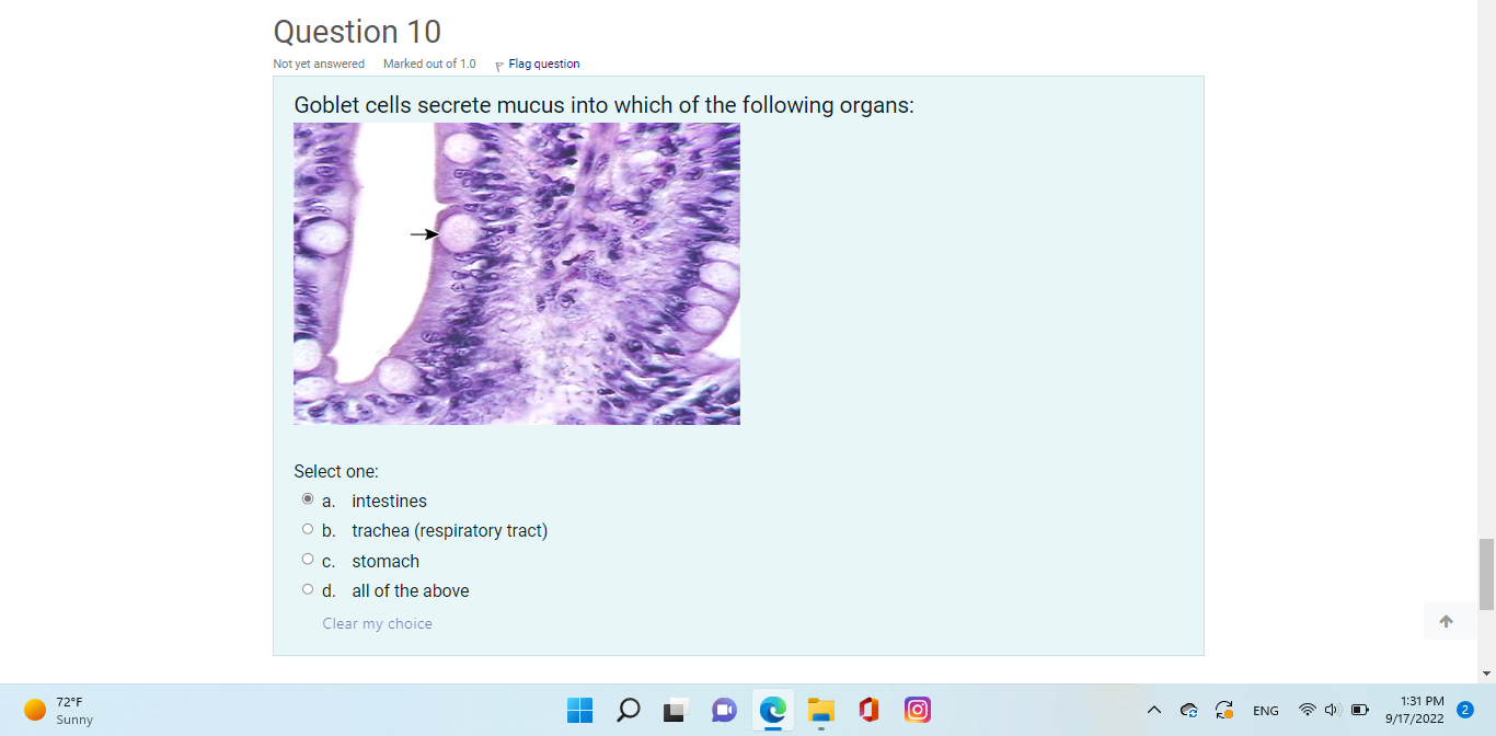 Solved Goblet cells secrete mucus into which of the | Chegg.com