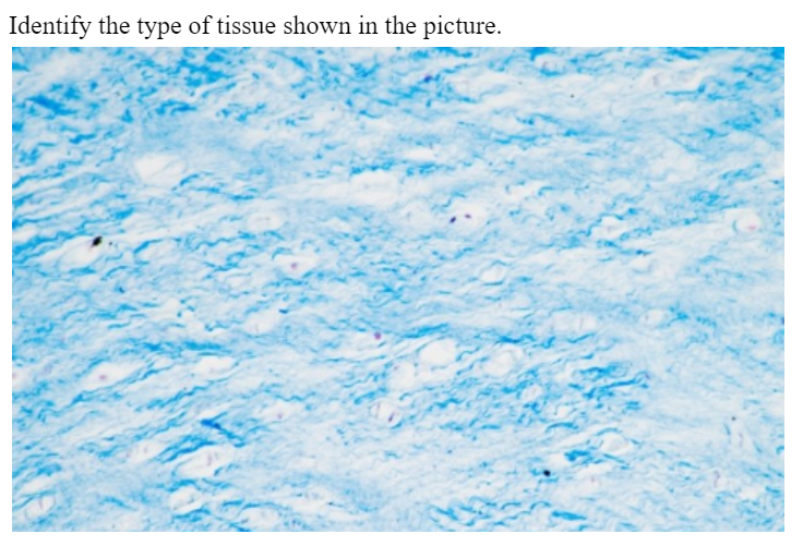 Identify the type of tissue shown in the picture. | Chegg.com
