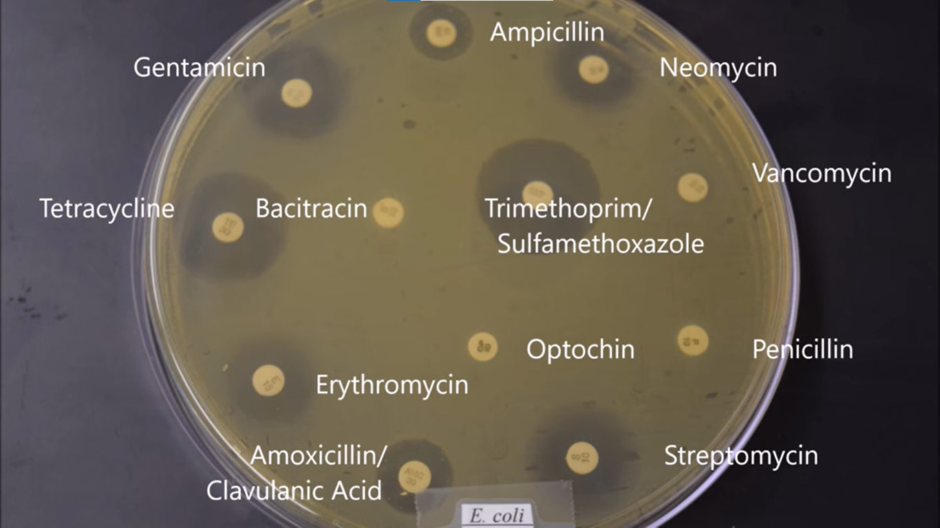 Measure the zone sizes of each antibiotic found in | Chegg.com