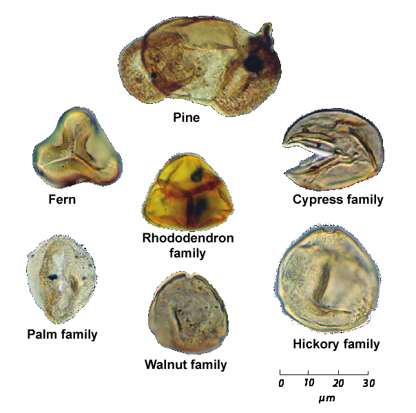 On the image below circle the types of pollen you see | Chegg.com