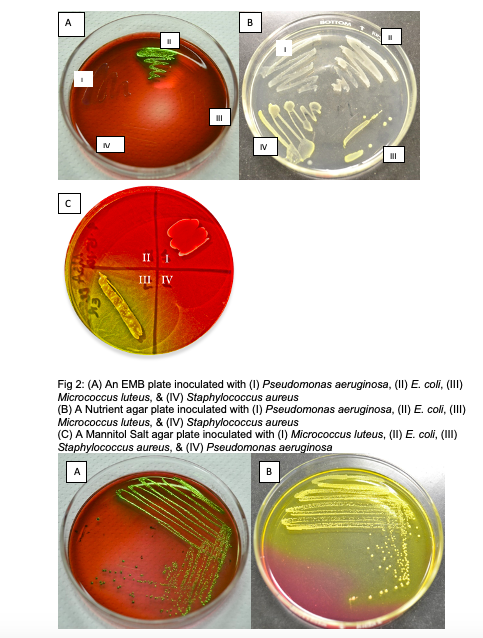 Solved Selective & Differential Media Lab Worksheet | Chegg.com