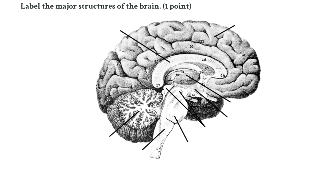 Solved Label The Major Structures Of The Brain 1 Point Chegg