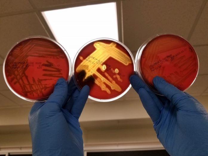 Blood Agar Alpha Beta Gamma