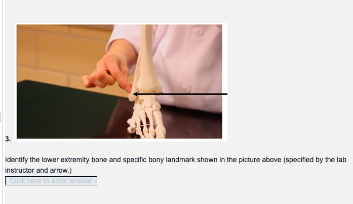 Solved Ont 3. Identify the forearm bone and specific bony | Chegg.com