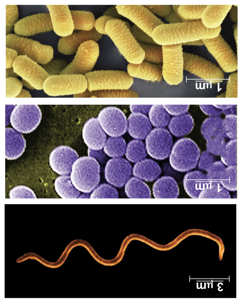 Solved 3 um 1 um 1 um | Chegg.com